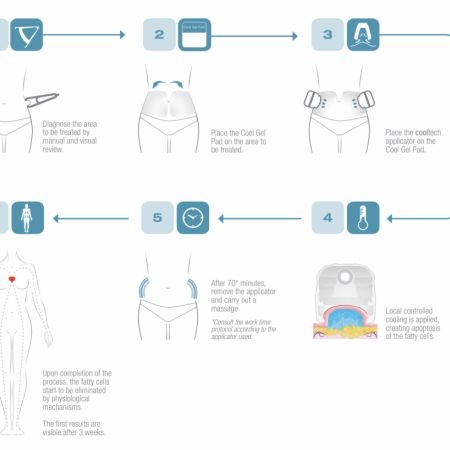 Cooltech Fat Freezing - Makhsoom