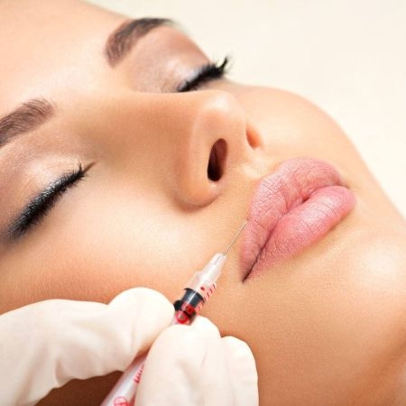 Lips Filler Injection - Makhsoom