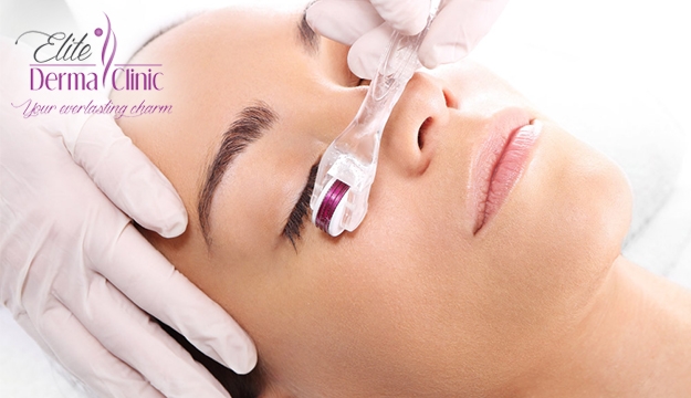 3-Sessions Eye Contour Dark Circle Mesotherapy - Makhsoom